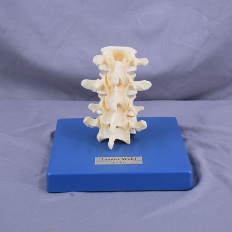 Kyoto-Kagaku-Lumbar-Model-(LII-LV)-Teaching-Model-Single-Part